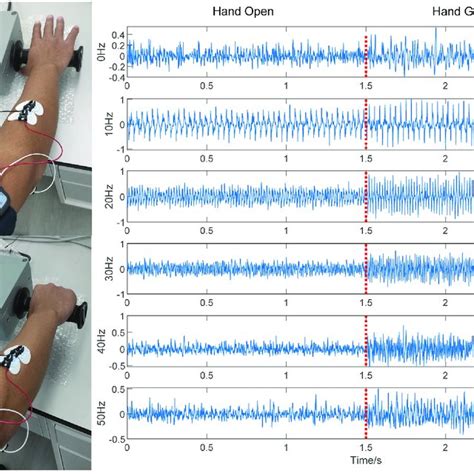 The Semg Signals For The Open And Grip Modes Of The Prosthetic Hand Download Scientific Diagram