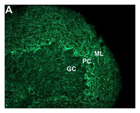 Low Power 20x Objective Photomicrographs Of Smi 31 Axonal Staining In