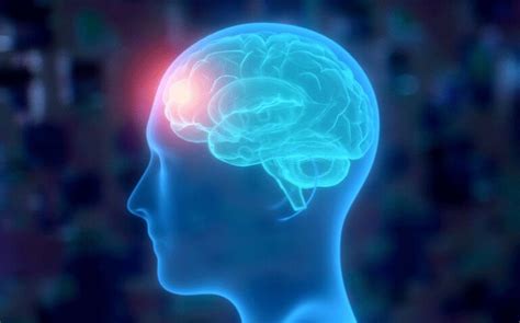 Enlarged Perivascular Spaces Revealed By Mri In Migraine Sufferers
