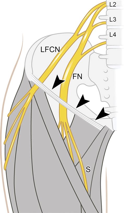 Us Of The Peripheral Nerves Of The Lower Extremity A Landmark Approach