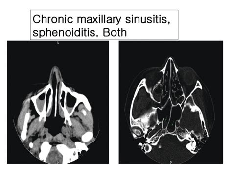 어 이건 뭐지 사진으로 보는 이비인후 질환 뉴스 한의신문