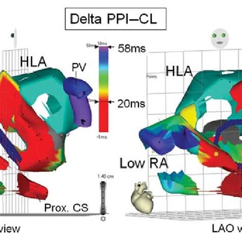 Pdf Three Dimensional Electroanatomic Entrainment Map In Atypical Atrial Flutter Late After