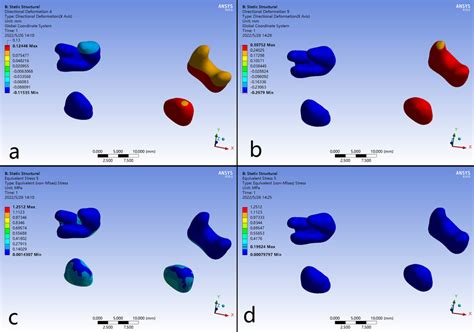 Displacement Patterns And Stress Distributions Of Periodontal Ligaments