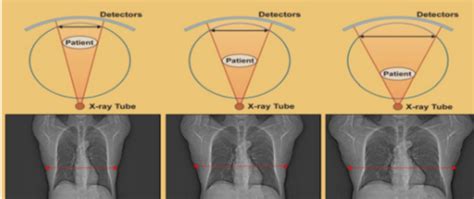 Unit Image Quality In CT Flashcards Quizlet