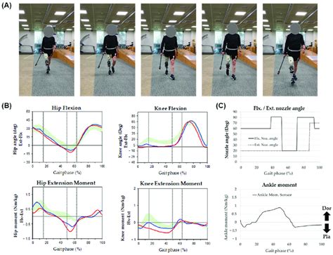 Gait Analysis In Passive Mode A Snapshots Of The Amputees Frontal