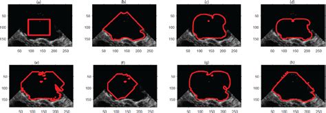 Figure 13 From A Fast Level Set Curve Flow Formulation By Logarithmic