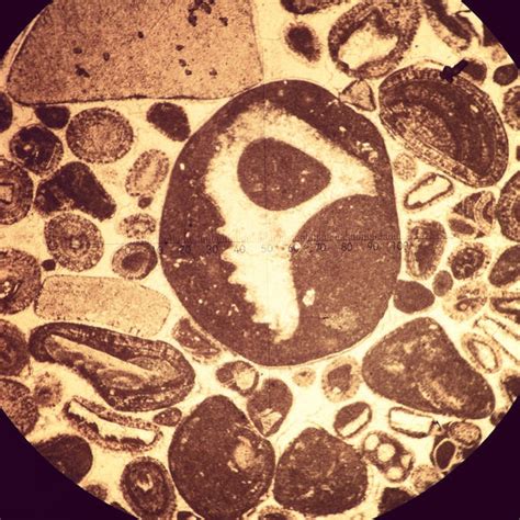 Limestone Under Microscope By Magicianmaxx On Deviantart