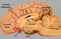 Lab 3 Brain Gross Anatomy Telencephalon