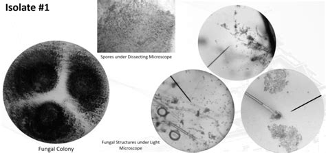 Solved Isolate 1 Spores Under Dissecting Microscope Fungal Structures Under Light Microscope