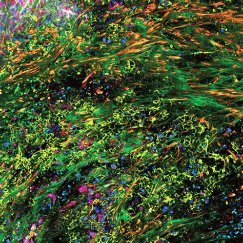 Advancing 3d Spatial Analysis With High Multiplex Imaging Labmate Online