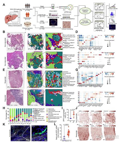 中国科学技术大学用单细胞 空间多组学技术揭示肝细胞癌微环境的肿瘤免疫屏障 知乎