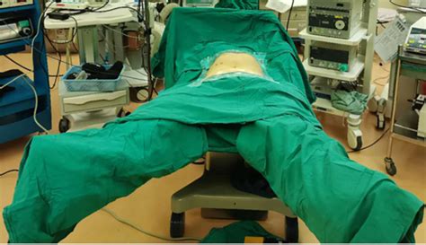 Laparoscopic Anatomical Liver Segment Vii Resection With Liver Parenchymal Transection Following