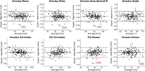 Bland Altman Plots Of The Proposed Algorithm Versus Expert Manual Download Scientific Diagram