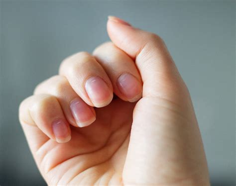 What Causes Dark Cuticles Fingernails