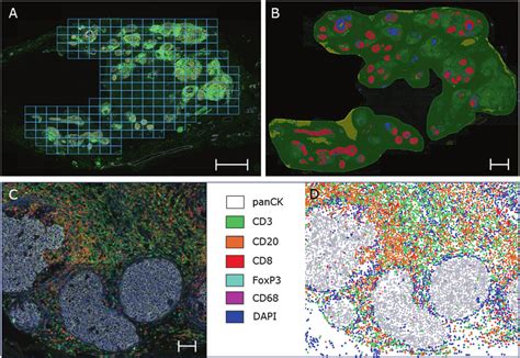 Pipeline Mif Imaging Of Whole Slides With Dcis A Example Of Download Scientific Diagram
