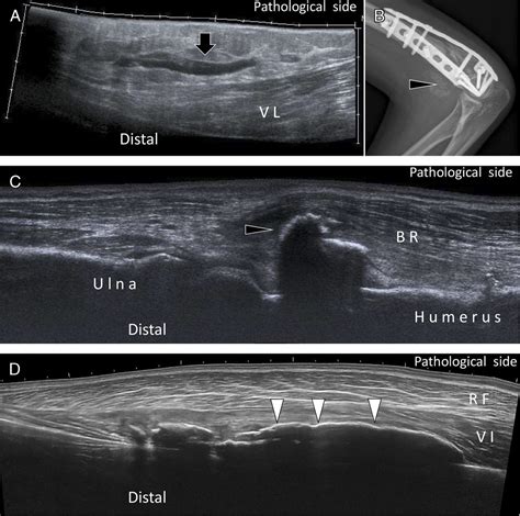 Ultrasound Imaging And Rehabilitation Of Muscle Disorders P