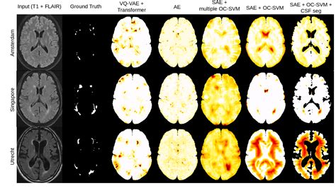 Figure 2 From One Class Svm On Siamese Neural Network Latent Space For