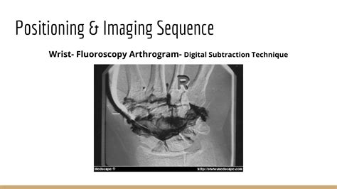 Arthrography Of The Shoulder Ankle And Wrist Pptx