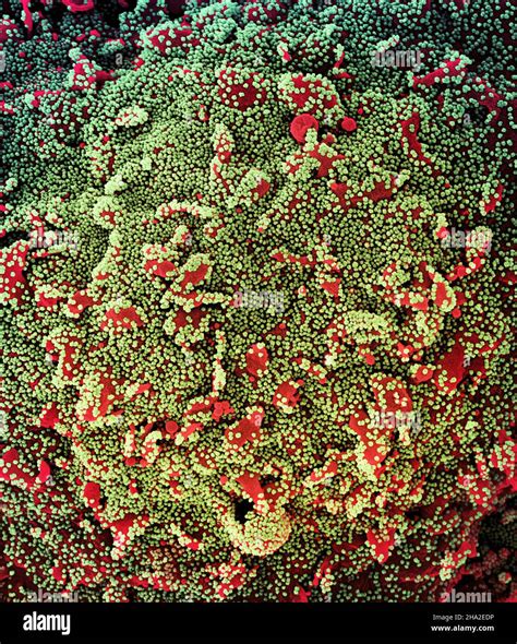 Colorized Scanning Electron Micrograph Of A Cell Red Heavily Infected With Sars Cov 2 Virus