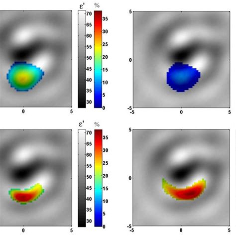 PDF Microwave Tomography Of Extremities Functional Fused Imaging Of Flow Reduction And