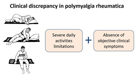 Polymyalgia Rheumatica Rheumatologist Dubai Blue Tree Clinics
