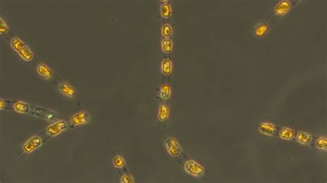 Brown Algae Under Microscope Labeled 2100 Algae Microscope Stock