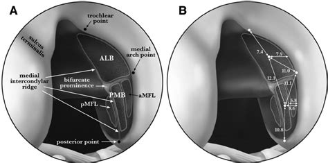 A Arthroscopic View Of The Femoral Attachment Of The Posterior Download Scientific Diagram