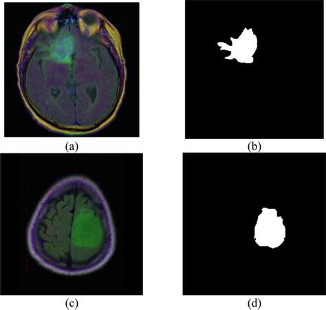 具有 Efficientnetb7 编码器的智能 Linknet 34 模型，用于脑肿瘤语义分割scientific Reports X Mol