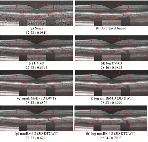A Visual Comparison Of The Denoising Results By Bm4d And Its Two