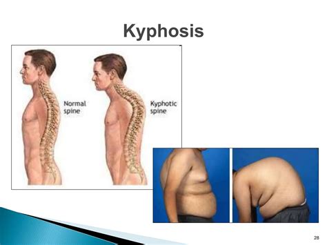 Vertebral Column Anatomy And Embryology At A Glance Ppt