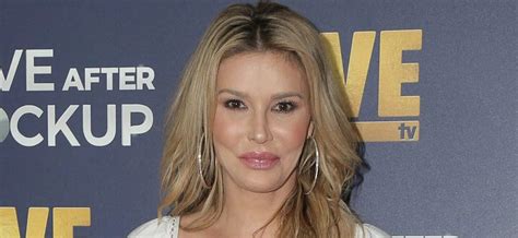 Brandi Glanville Suffers Severe Chemical Burns After Attempting To