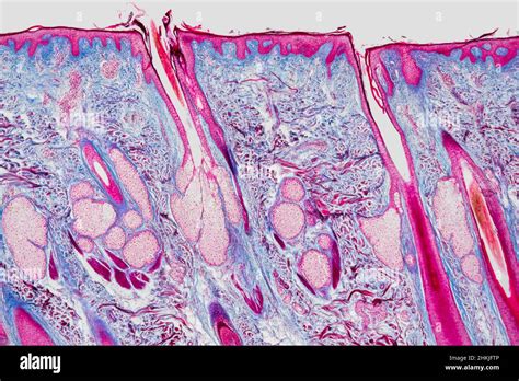 Human Scalp Light Micrograph Stock Photo Alamy