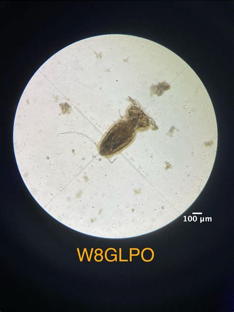 Fish Parasites Rparasitology
