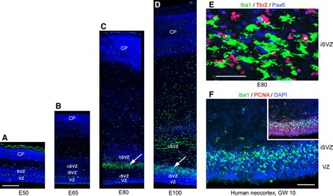 Iba1 Microglia Colonize The Proliferative Zones Of The Developing