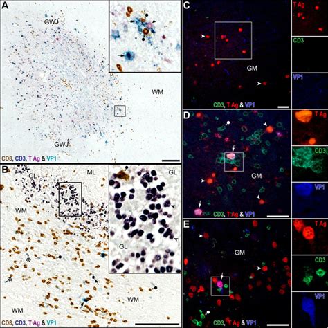 Cd8 Positive T Cells Aggregate Mostly Around Cells With Intact Nuclei Download Scientific