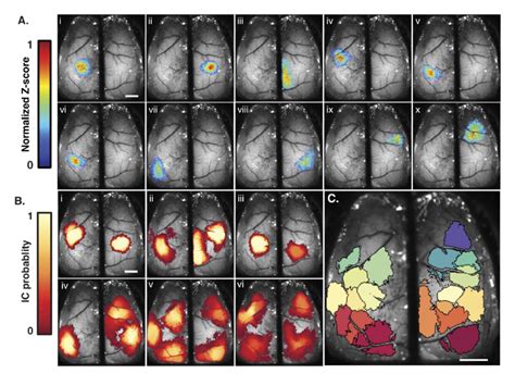Functional Segmentation Of Cerebral Cortical Activity For Individual