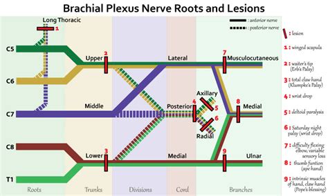 Brachial Plexus Schematic