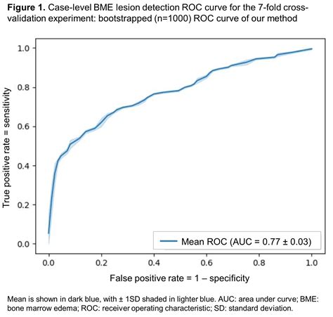 Development Of A Deep Learning Algorithm For The Detection Of Sacroiliitis On Mri In Patients
