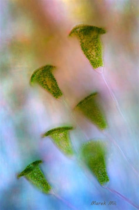 Vorticella Under Microscope