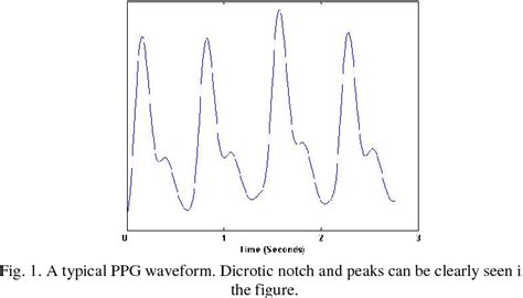 Figure 1 From Application Of Wavelets Based Multiresolution Analysis To Detect Relevant Points