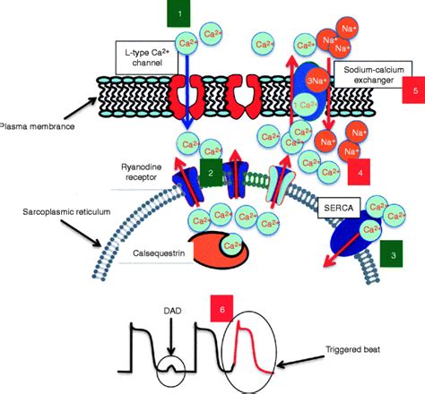 Catecholaminergic Polymorphic Ventricular Tachycardia Thoracic Key