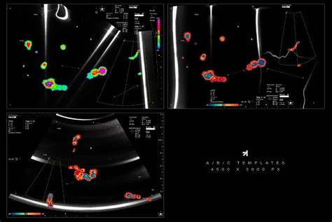 echo scan distortion effect youworkforthem