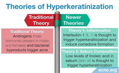 Hyperkeratinization Acne
