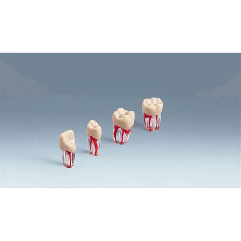 Model Dinte Frasaco Cu Canale Radiculare Dexellence