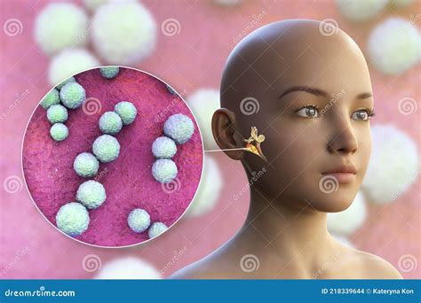 Streptococcus Structure Bacteria Streptococcus Infographics Vector Streptococcus Structure Bacteria Streptococcus Infographics Vector