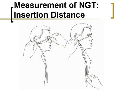 SPM Skills Lab Nasogastric Tube NGT