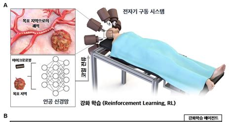 의료용 마이크로로봇 인체 내에서 정밀하게 제어한다