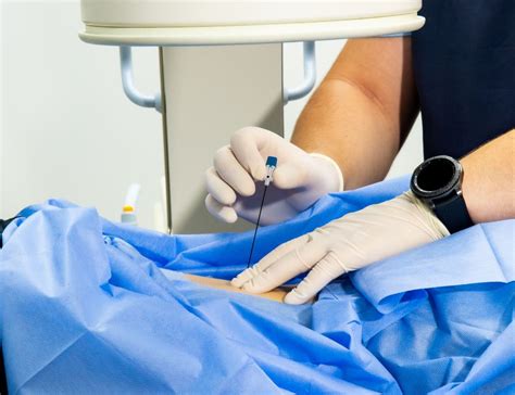 Facet Joint Injection Laser Spine Center