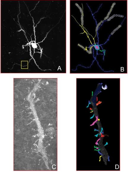 Multiple Representations Of The Same Medium Spiny Neuron Taken From The