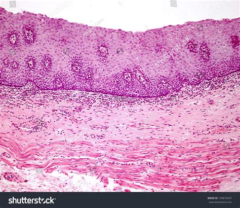 Histology Slides Database Stratified Squamous Keratinized